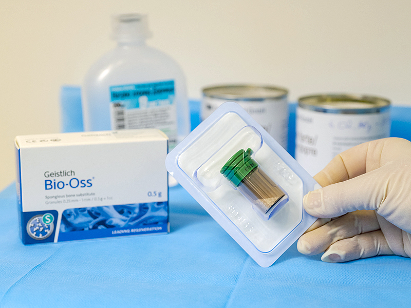 Кісткозамінний матеріал Bio-Oss - Стоматологічна клініка Стоматпрофі